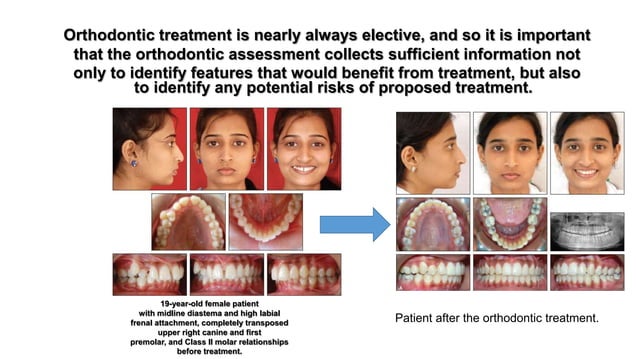 Orthodontic assessment of the patient | PPTX | Dental Health | Diseases ...
