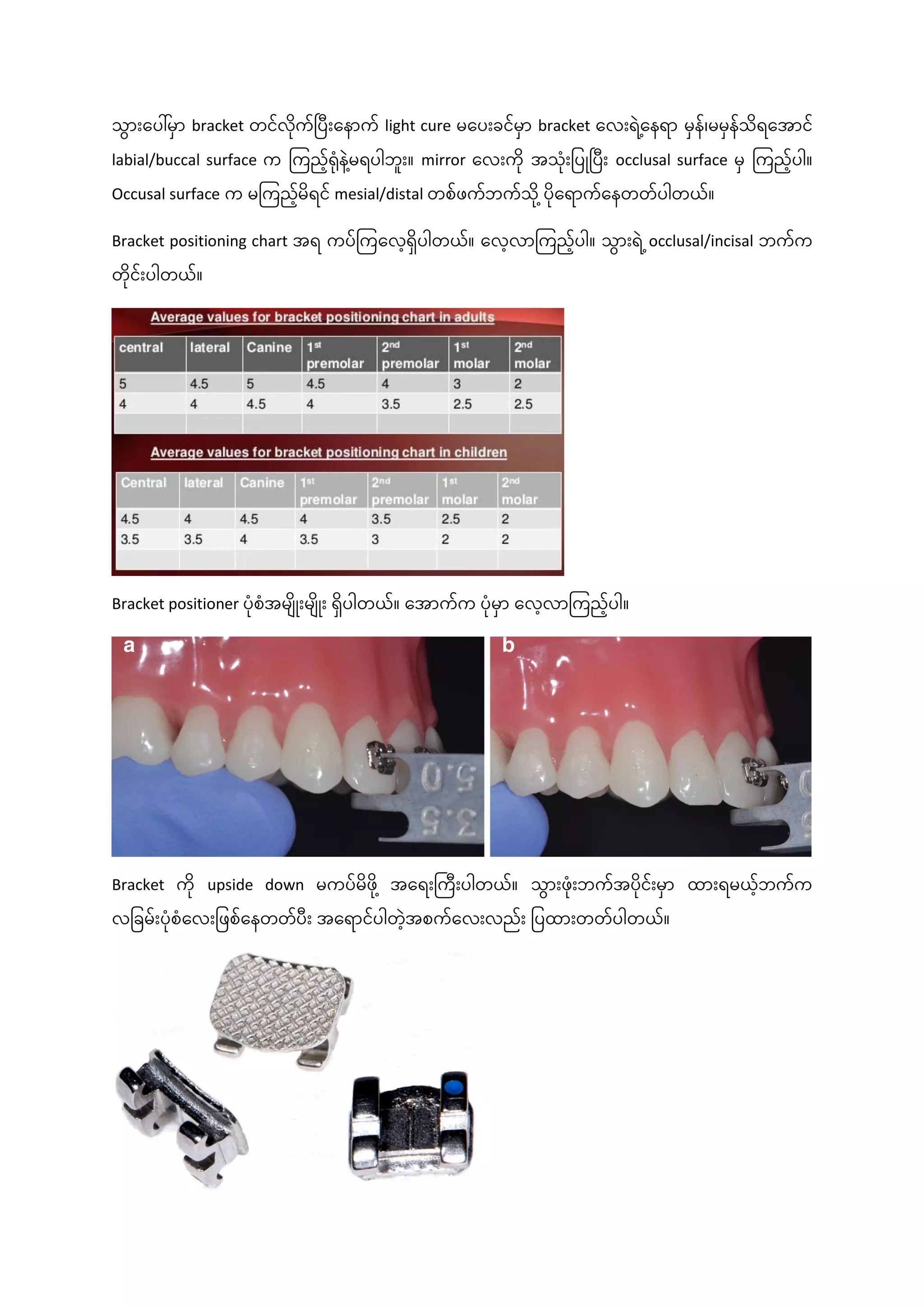 Orthodontic bracket positioning by dr nayaung | PDF
