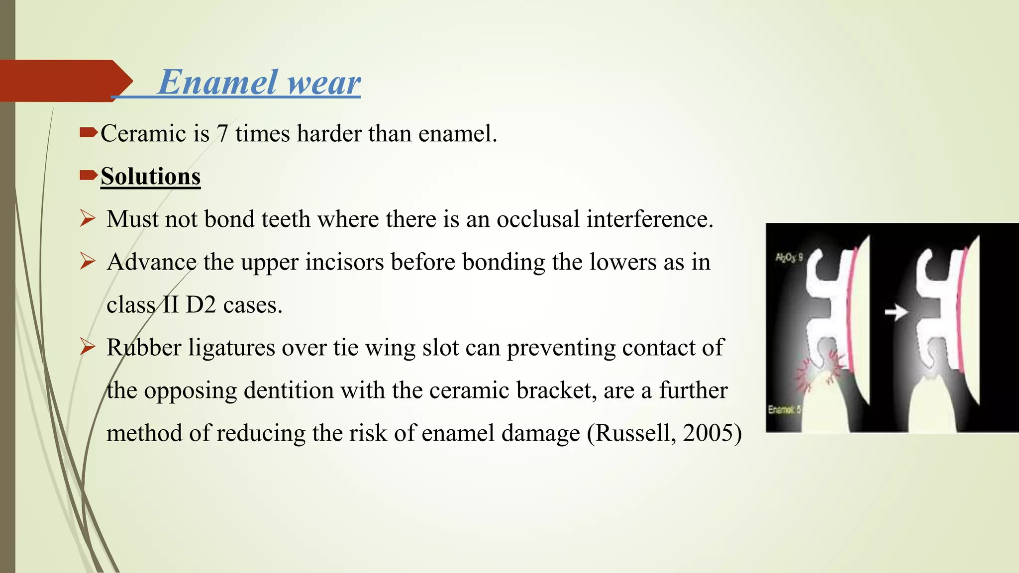 Orthodontic brackets | PPTX