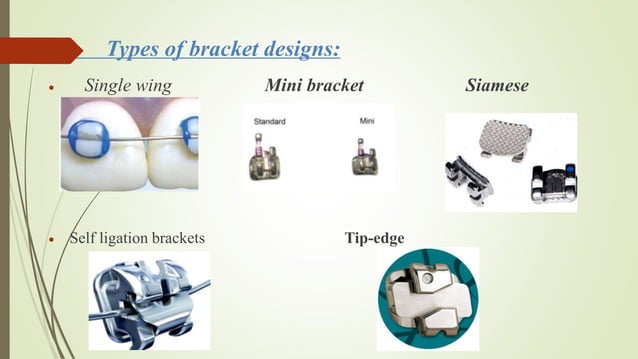 Orthodontic brackets | PPTX | Dental Health | Diseases and Conditions
