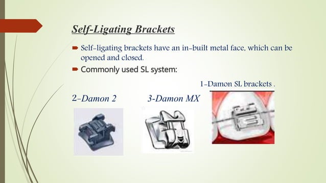 Orthodontic brackets | PPTX | Dental Health | Diseases and Conditions