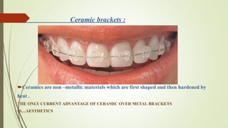 Orthodontic brackets | PPTX