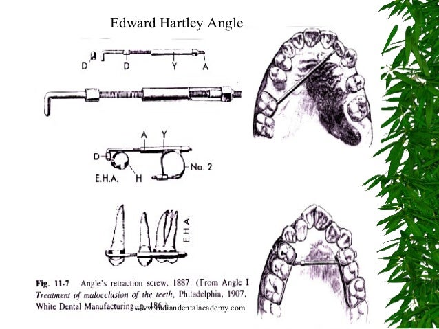 Orthodontic brackets part 1