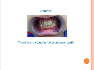 Orthodontic case copy | PPTX