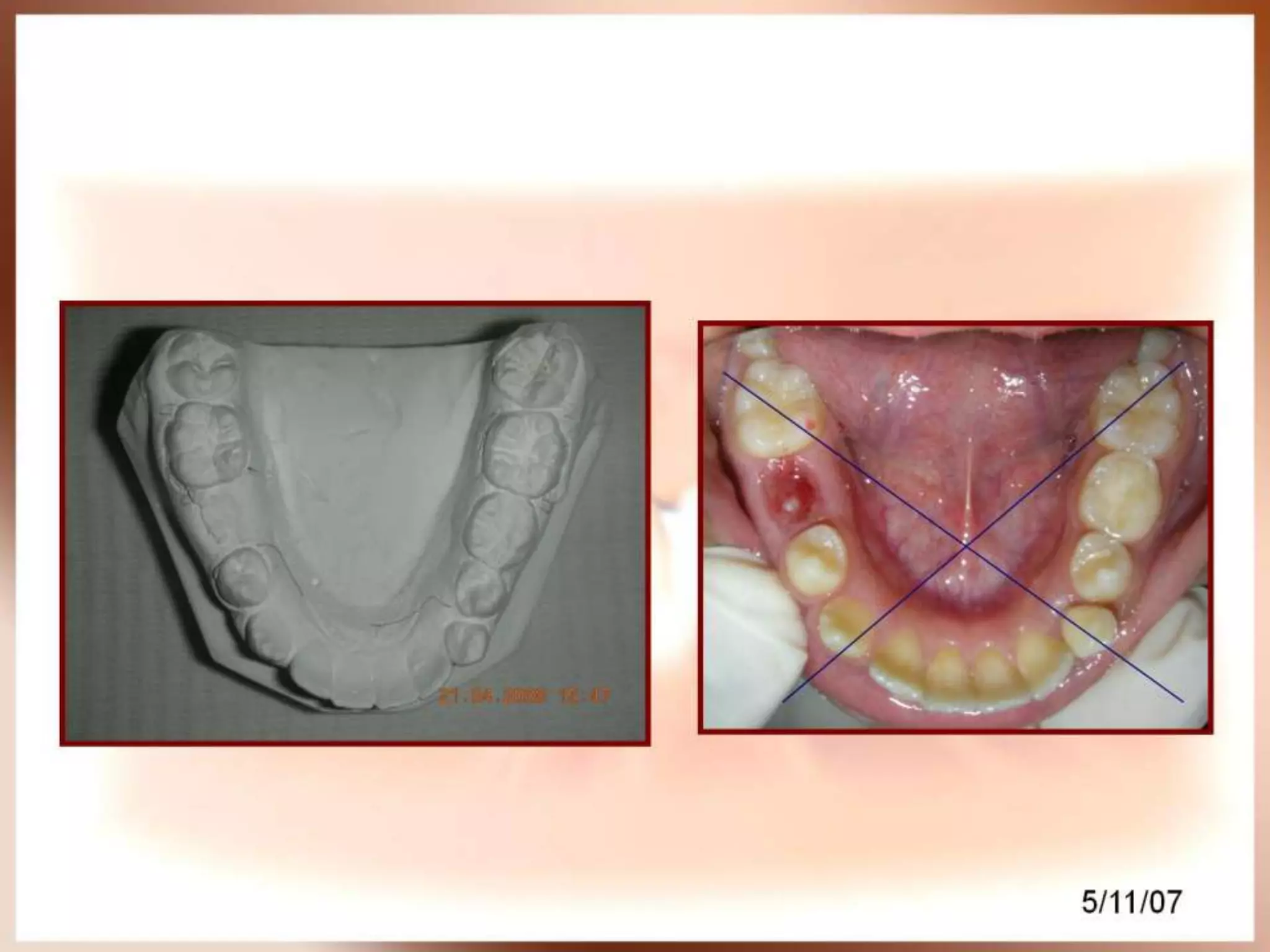 Orthodontic case presentation | PPTX