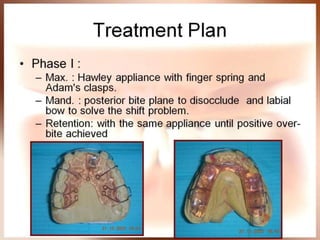 Orthodontic case presentation | PPTX