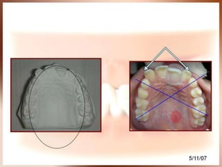 Orthodontic case presentation | PPTX