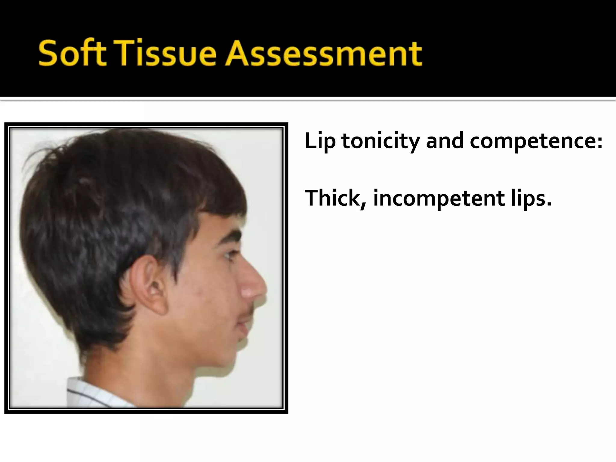 Orthodontic case presentation | PPTX