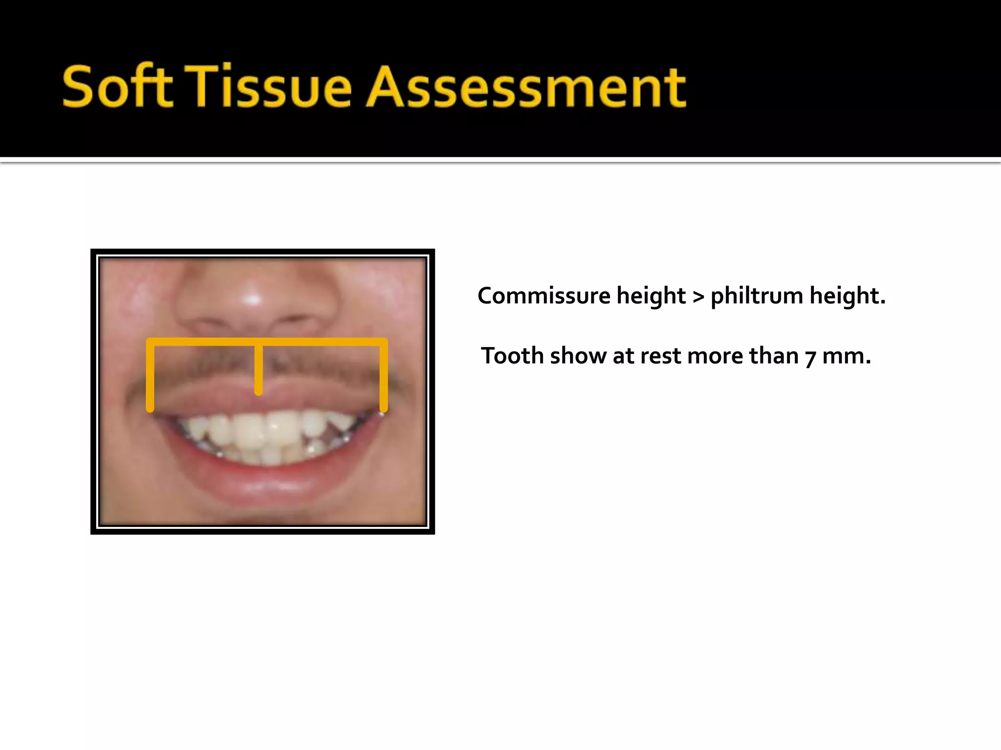Orthodontic case presentation | PPTX