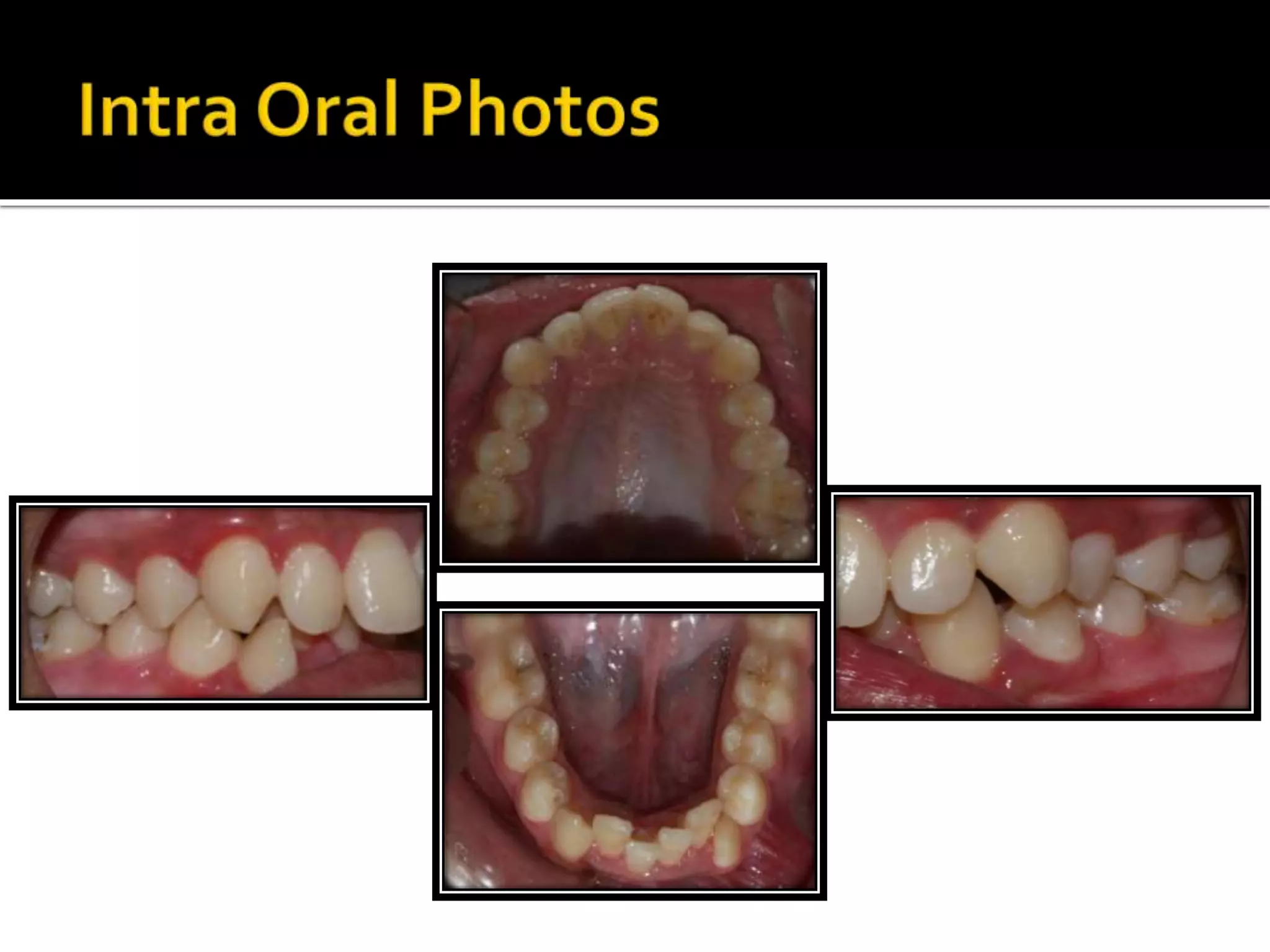 Orthodontic case presentation | PPTX