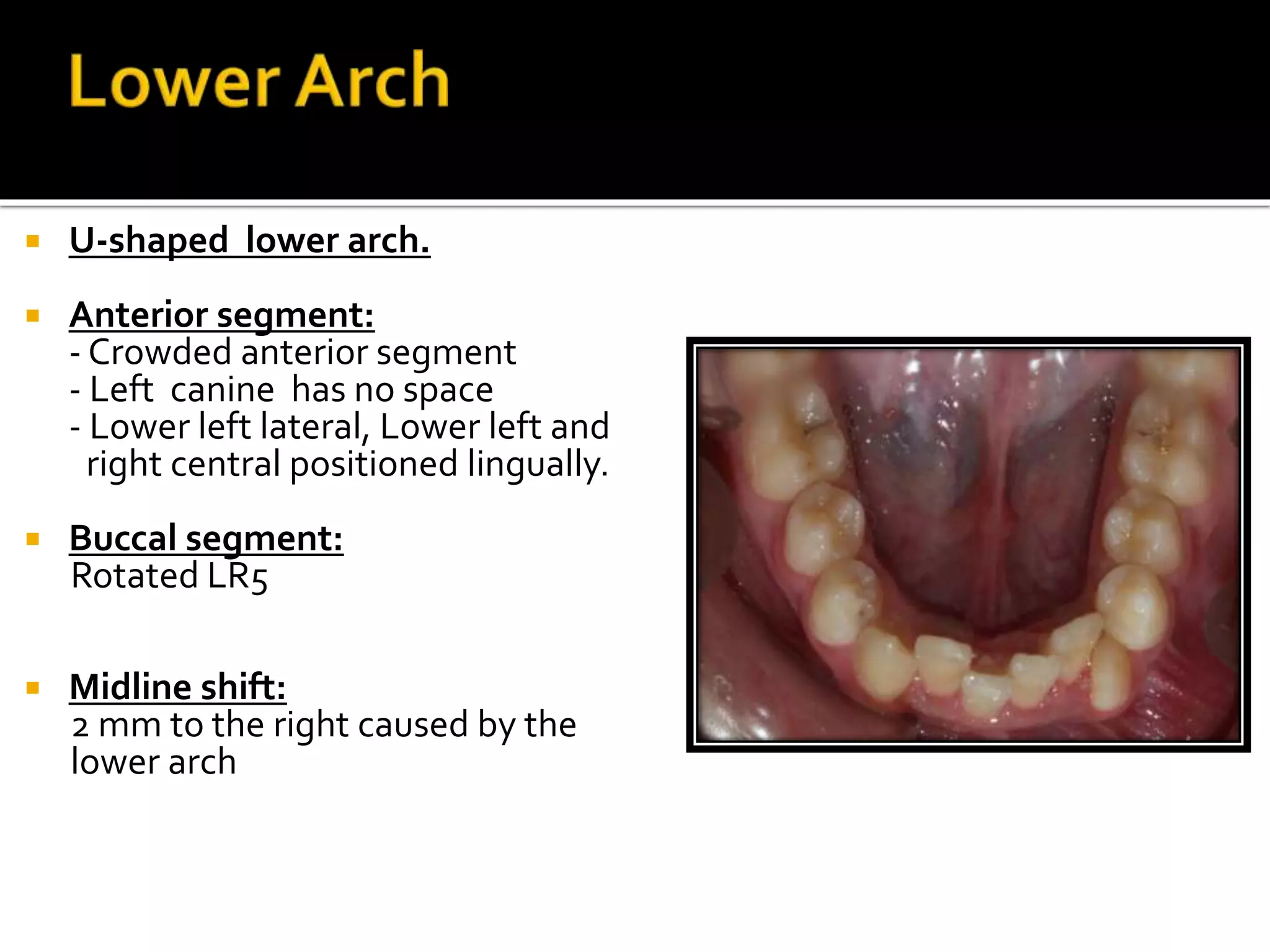Orthodontic case presentation | PPTX