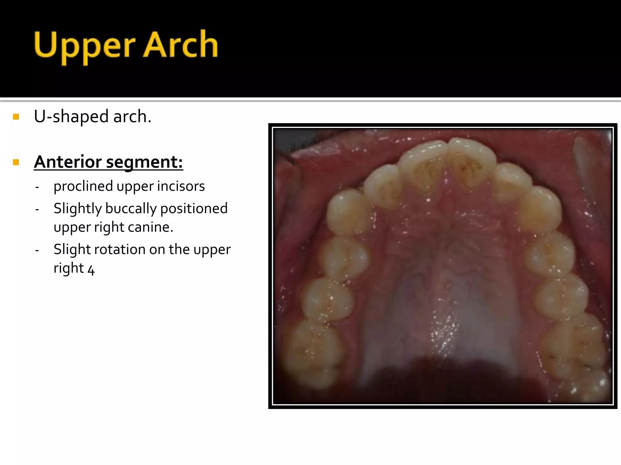 Orthodontic case presentation | PPTX