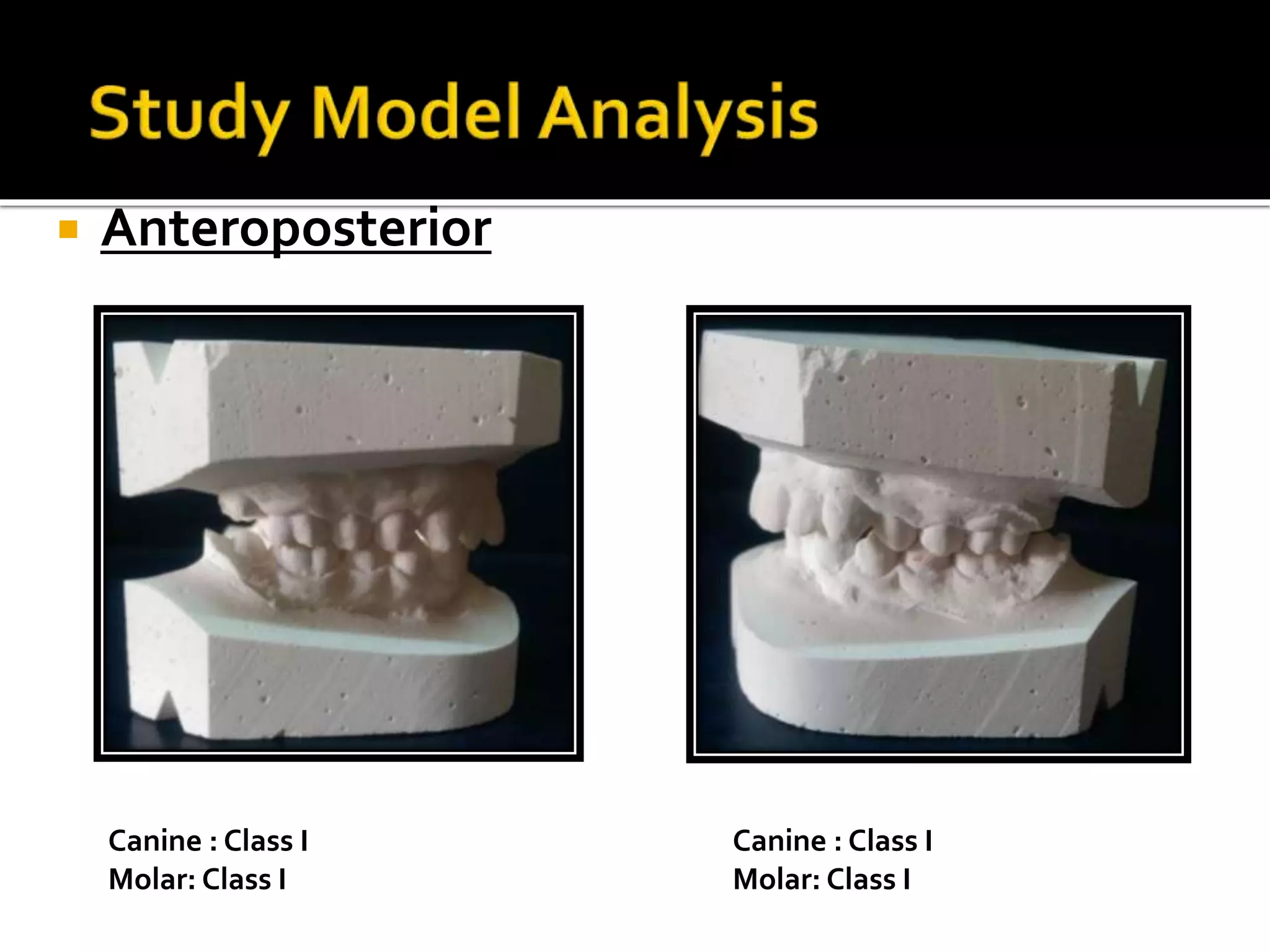 Orthodontic case presentation | PPTX