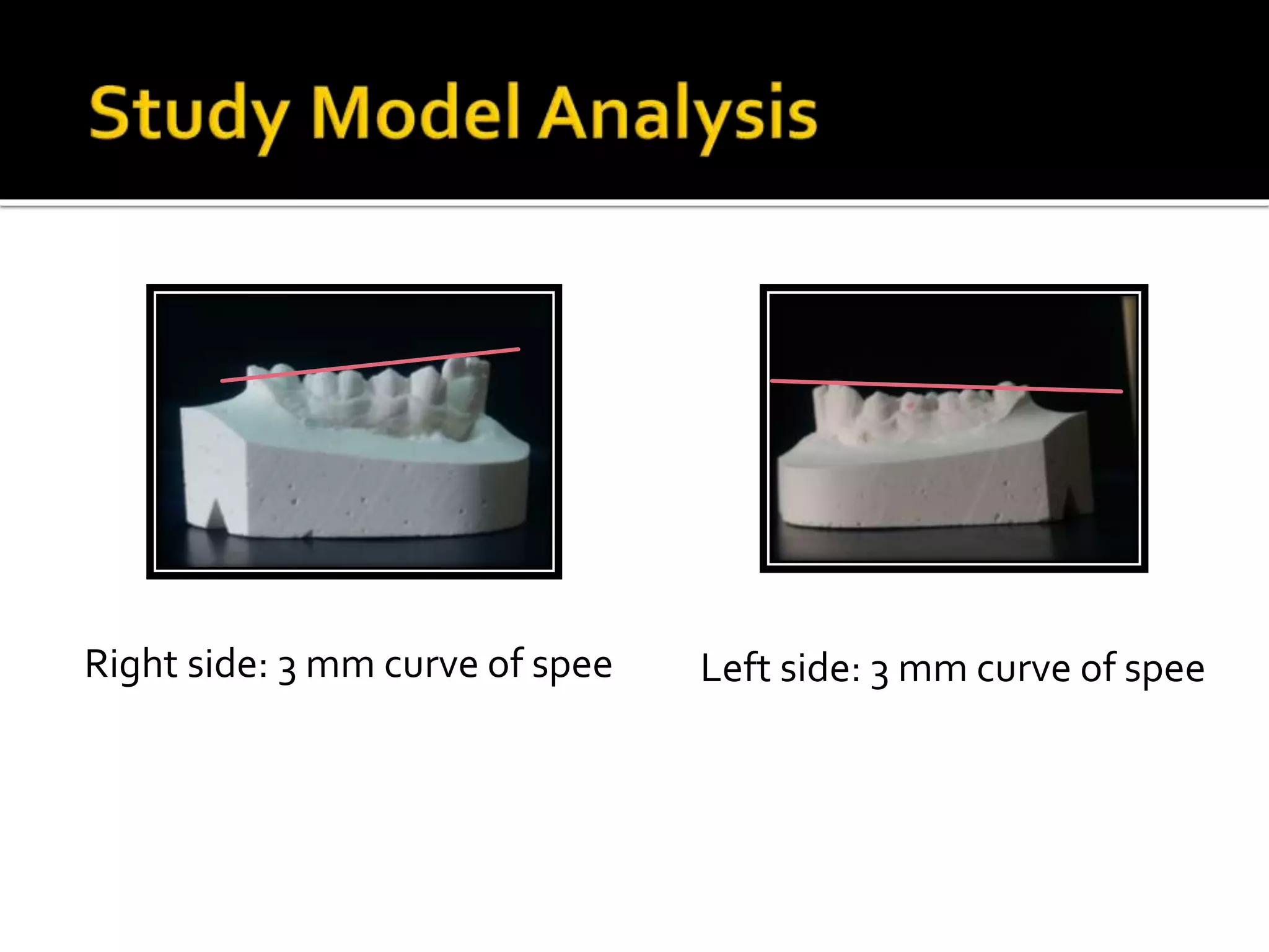 Orthodontic case presentation | PPTX
