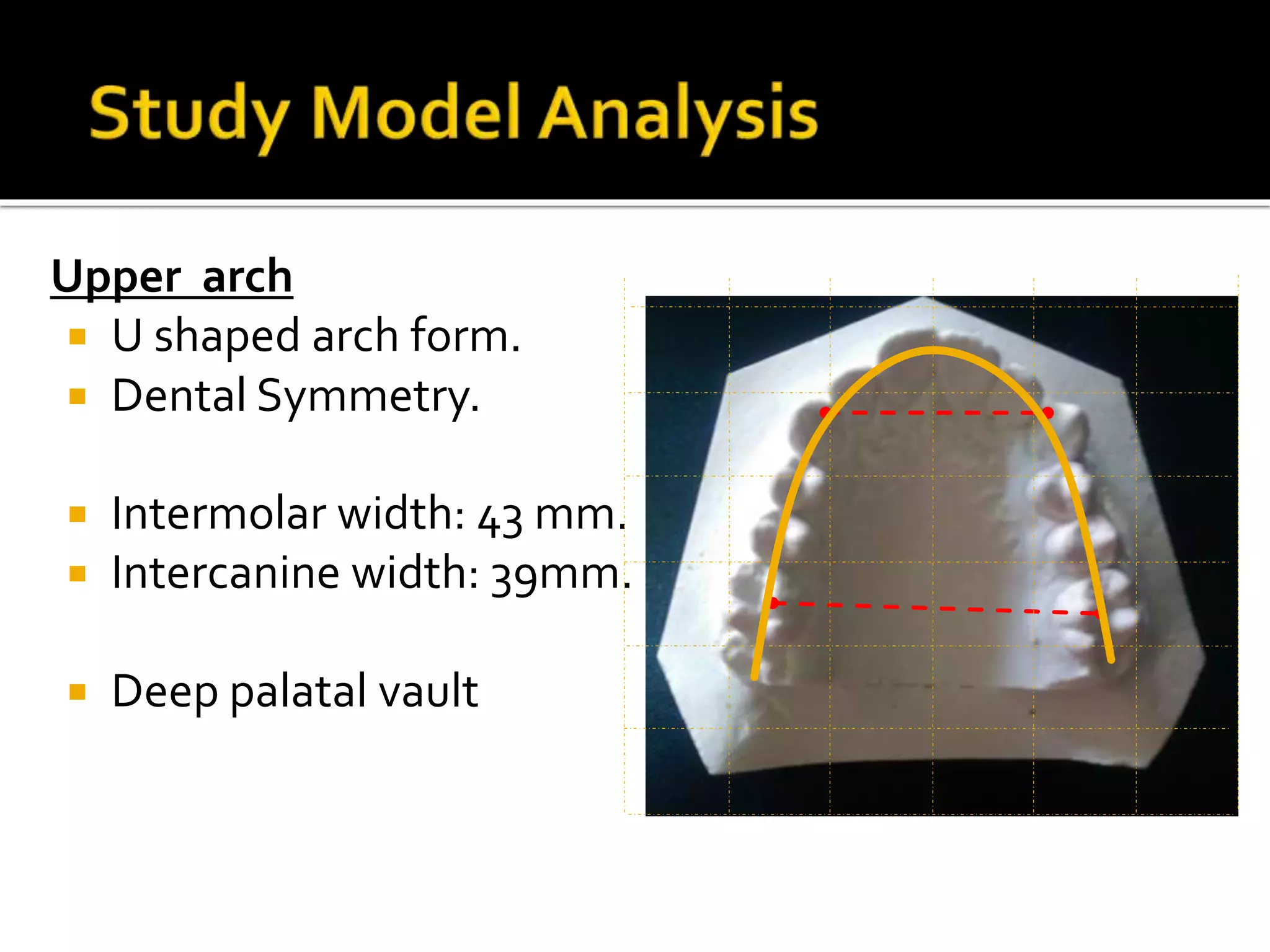 Orthodontic case presentation | PPTX