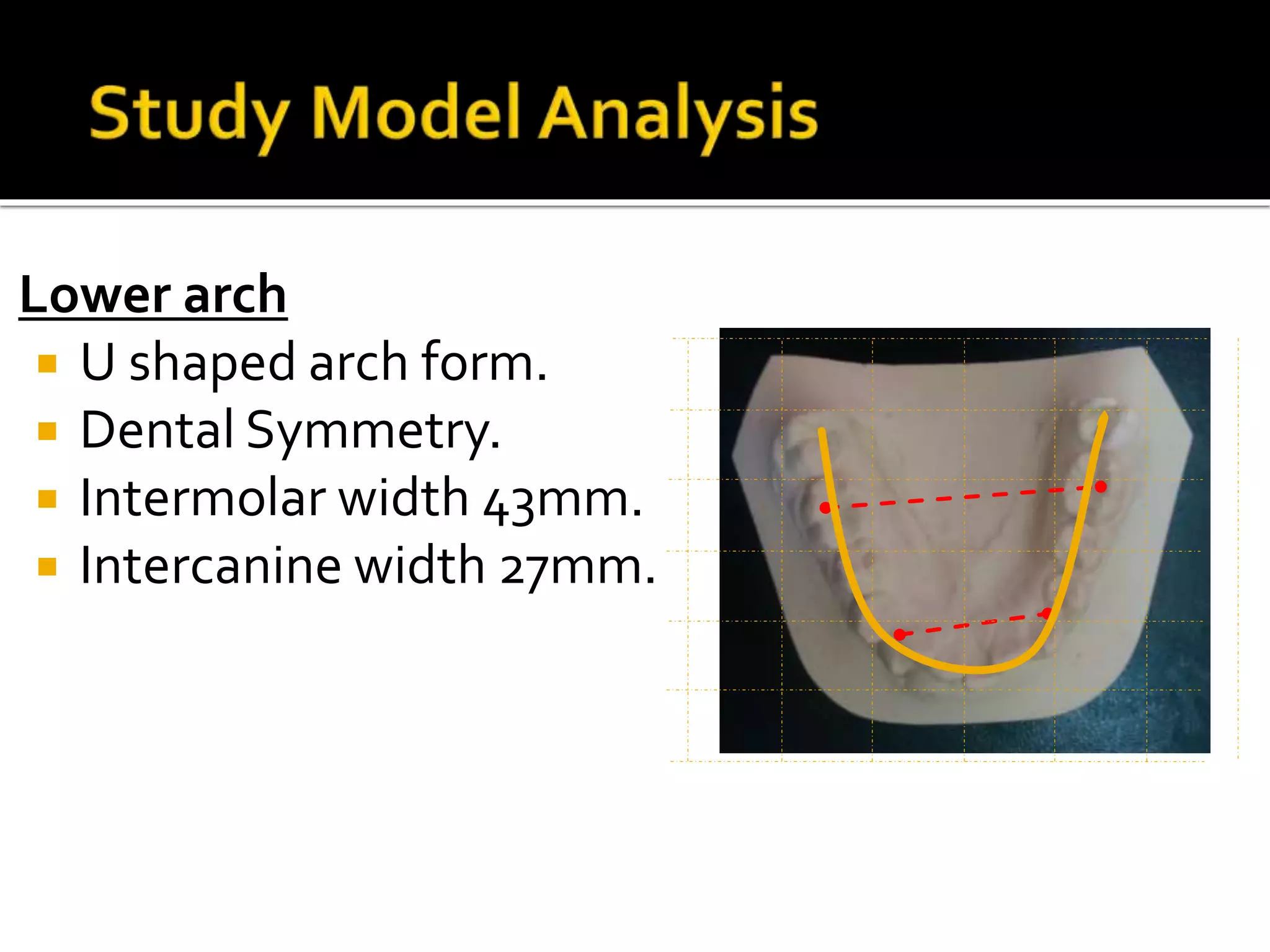 Orthodontic case presentation | PPTX