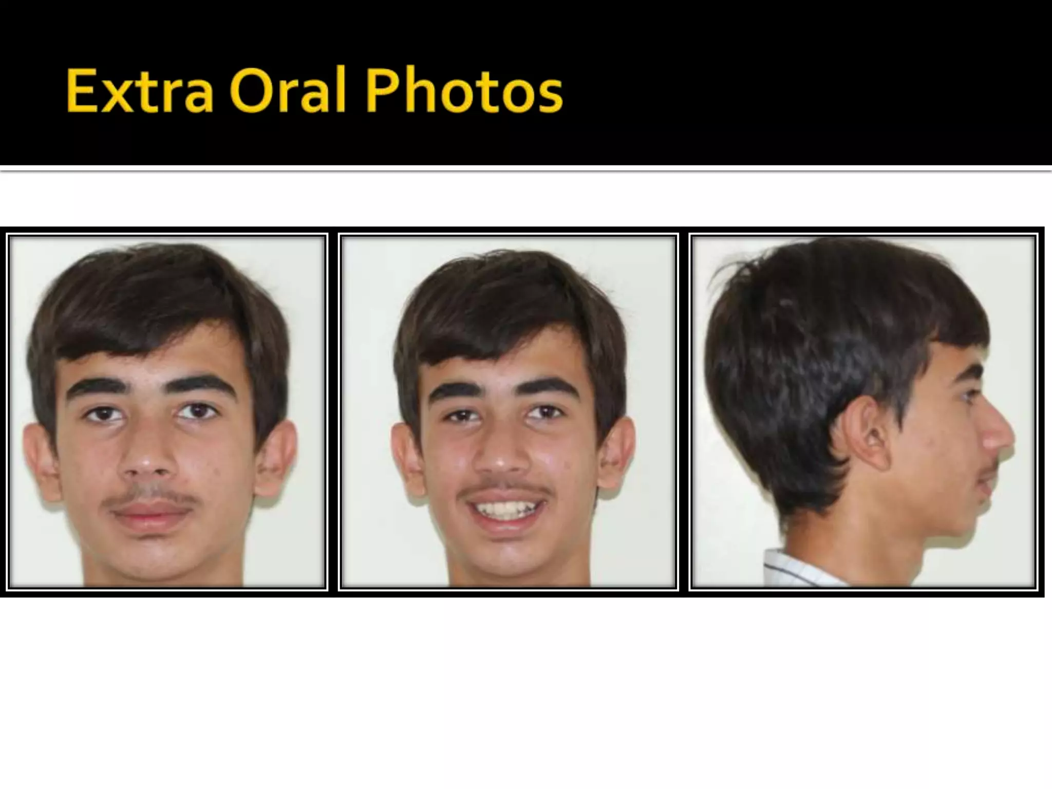 Orthodontic case presentation | PPTX