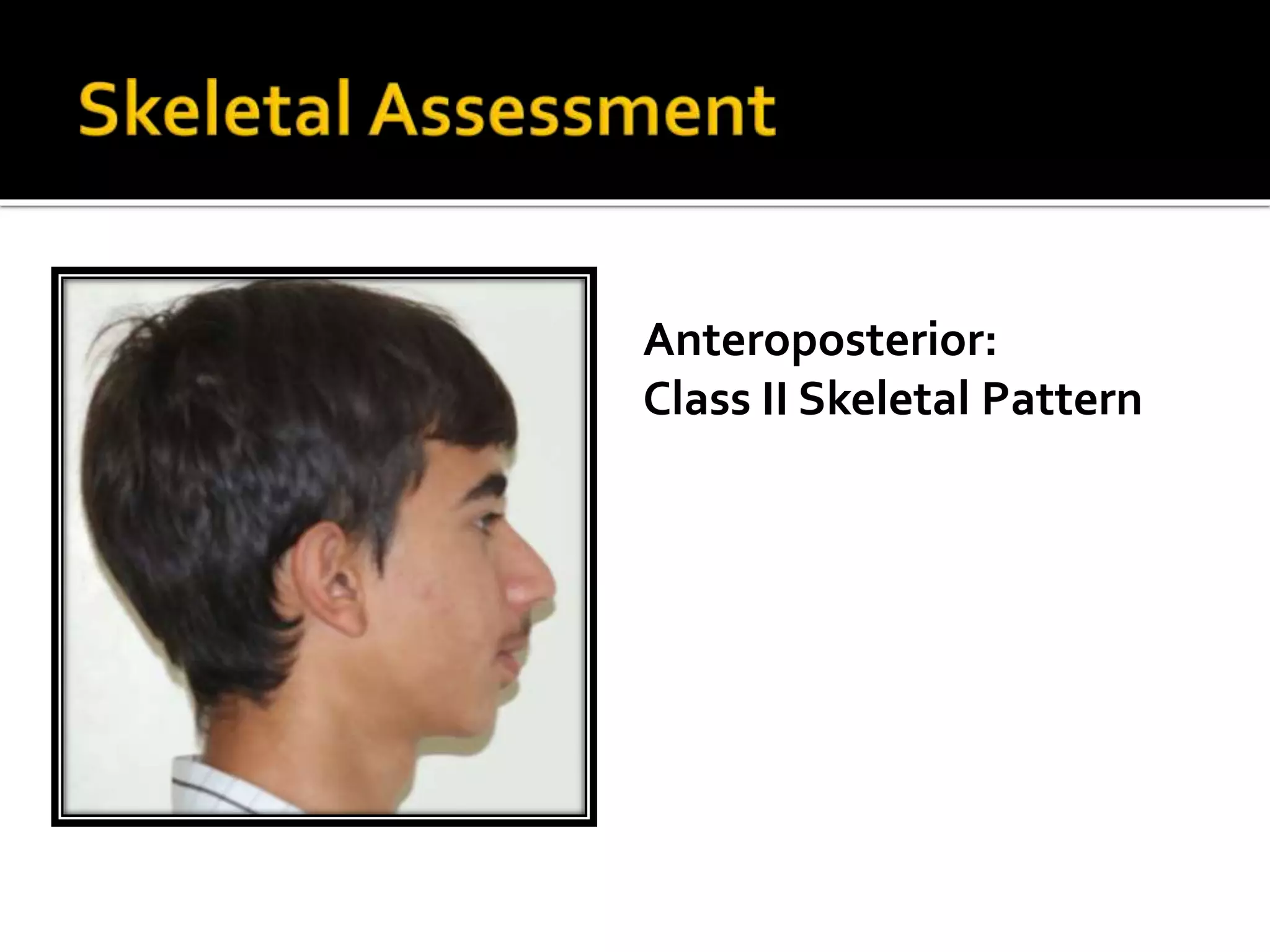Orthodontic case presentation | PPTX