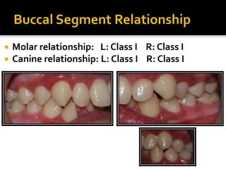 Orthodontic case presentation | PPTX