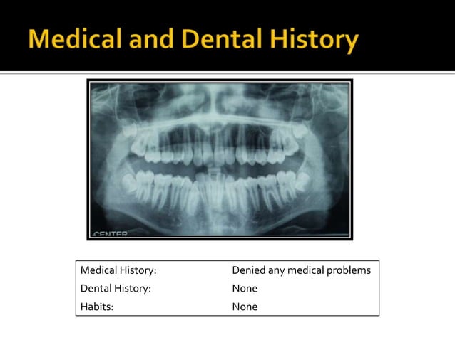 Orthodontic case presentation | PPTX