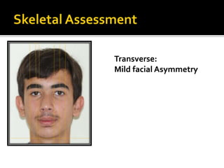 Orthodontic case presentation | PPTX