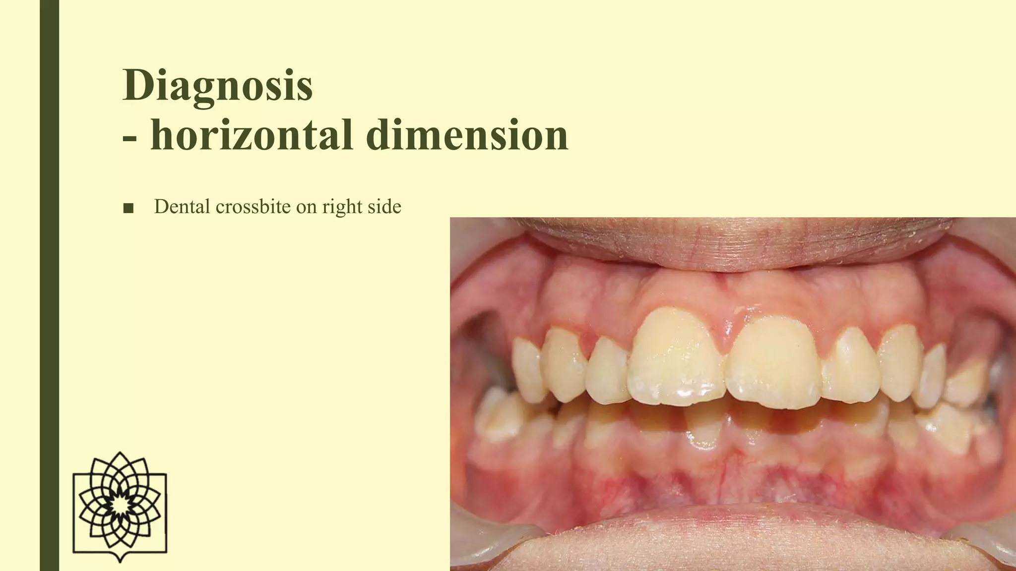 an Example for Orthodontic case presentation | PPTX
