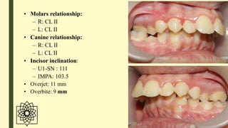 an Example for Orthodontic case presentation | PPTX