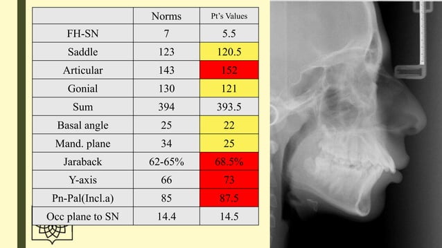 an Example for Orthodontic case presentation | PPTX | Dental Health ...