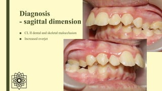 an Example for Orthodontic case presentation | PPTX