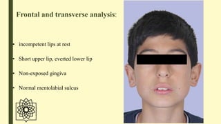 an Example for Orthodontic case presentation | PPTX