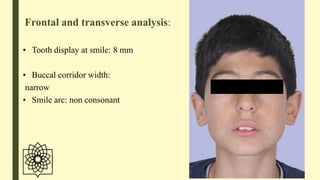 an Example for Orthodontic case presentation | PPTX