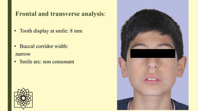 an Example for Orthodontic case presentation | PPTX | Dental Health ...
