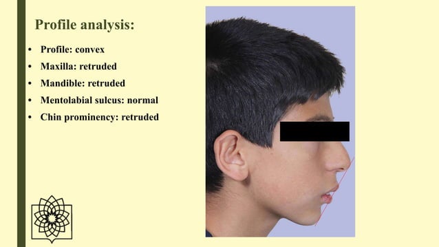 an Example for Orthodontic case presentation | PPTX | Dental Health ...