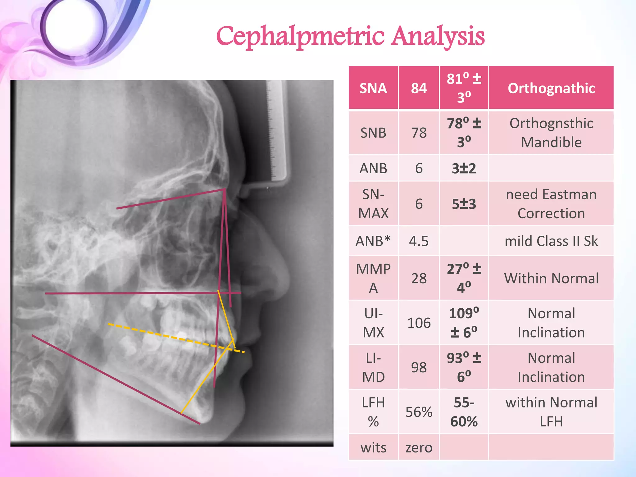 Orthodontic case presentation Dr-wessam alsaadi | PPTX