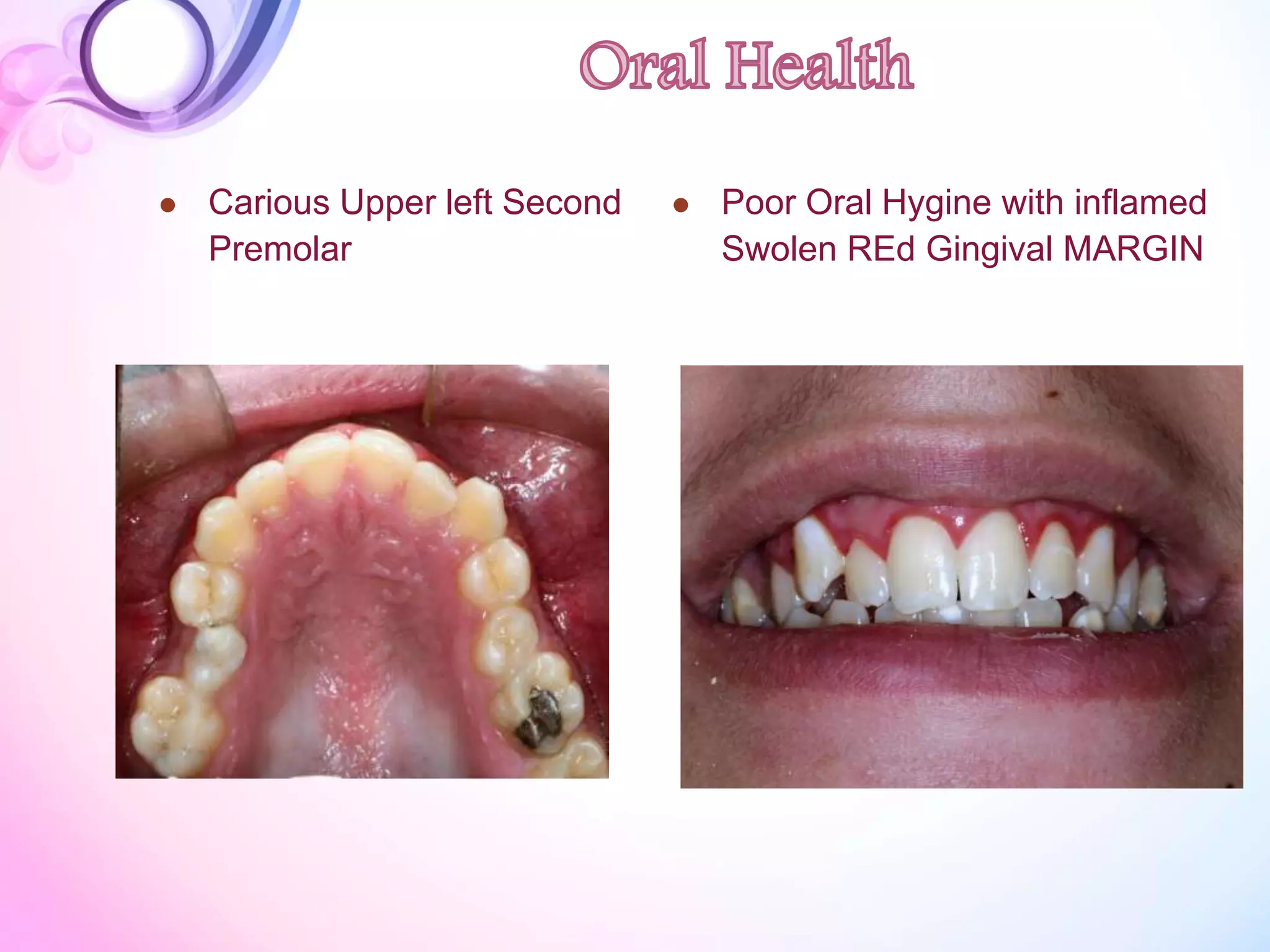 Orthodontic case presentation Dr-wessam alsaadi | PPTX