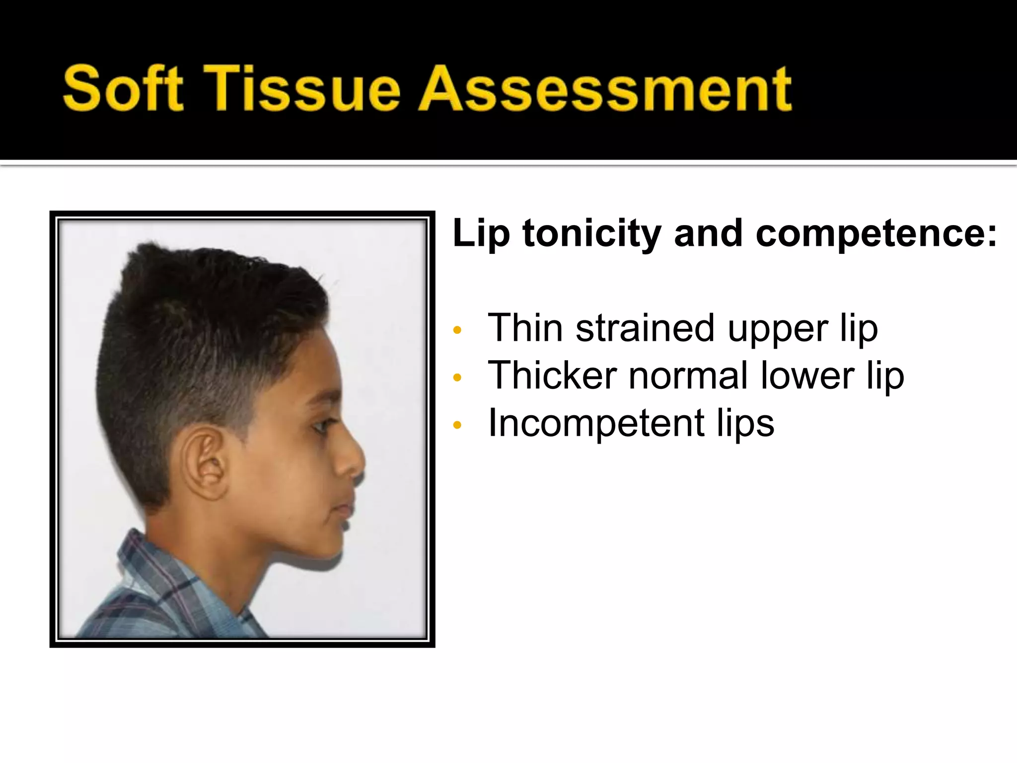 Dr Lana obeidat Orthodontic case presentation | PPTX