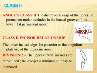 Orthodontic class 2 div 2 | PPTX