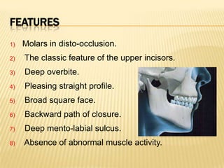 Orthodontic class 2 div 2 | PPTX