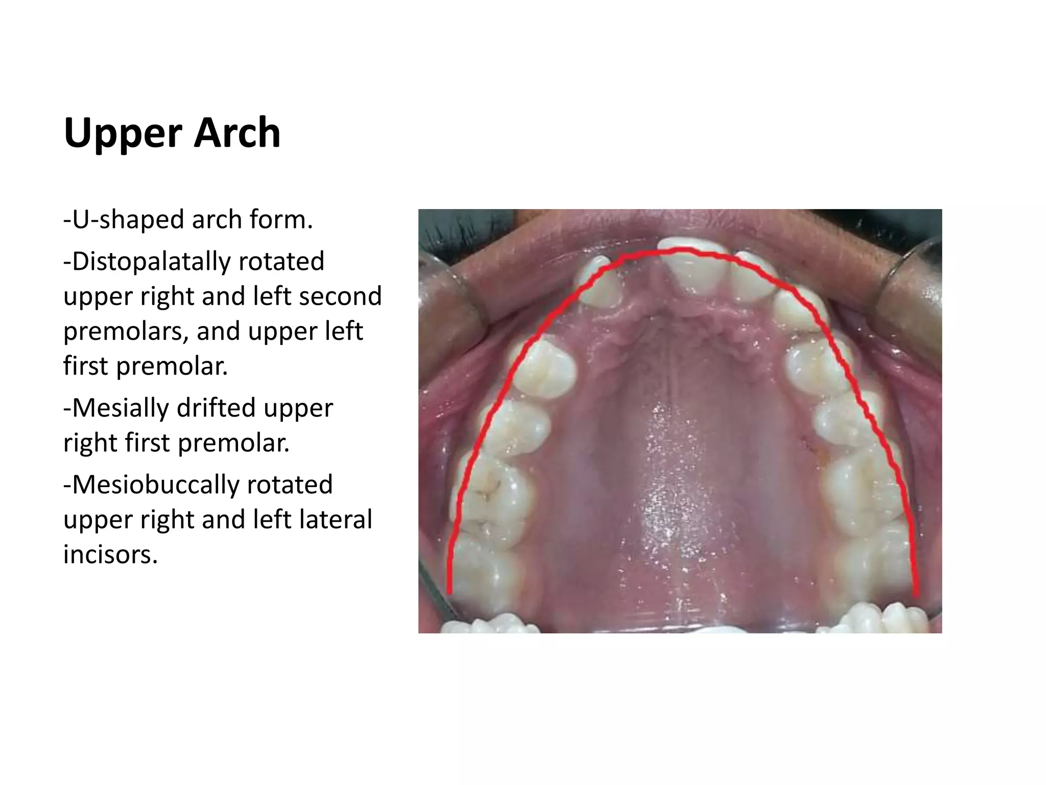 Orthodontic clinical case presentation dr - hadeel almasri | PPTX