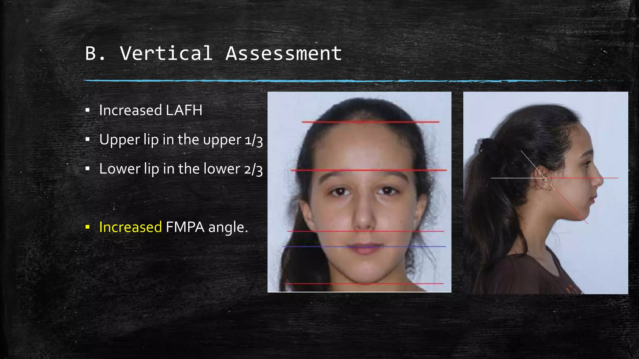 Orthodontic clinical case presentation - Dr shareef alshanableh | PPTX