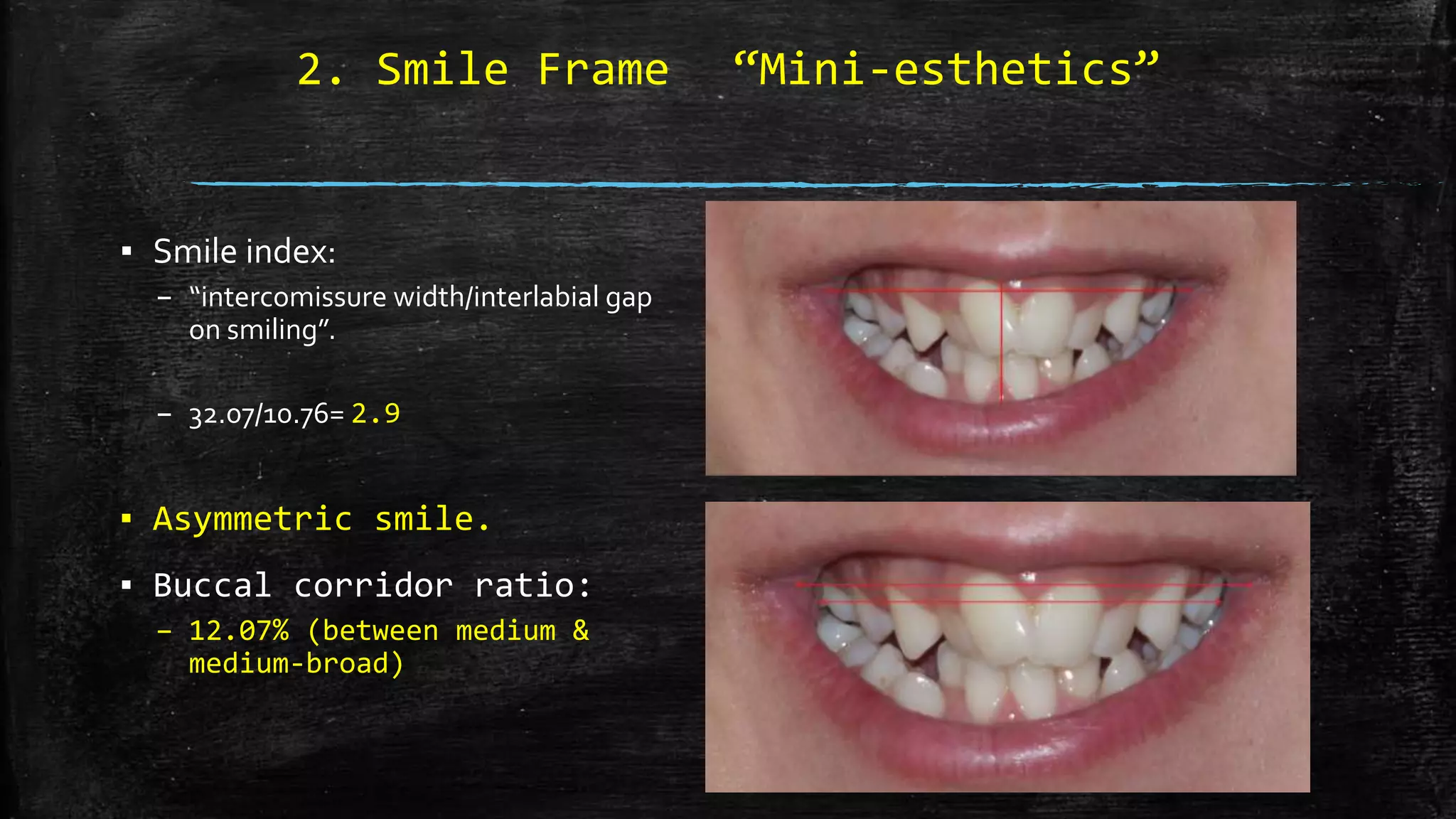 Orthodontic clinical case presentation - Dr shareef alshanableh | PPTX