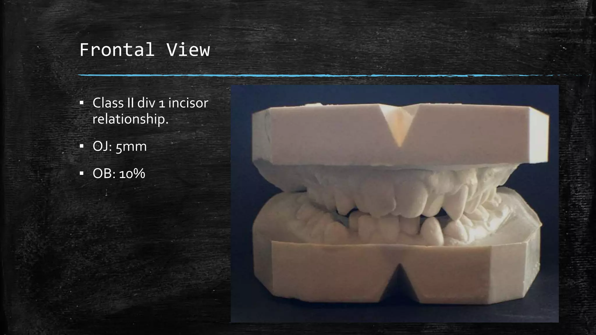 Orthodontic clinical case presentation - Dr shareef alshanableh | PPTX
