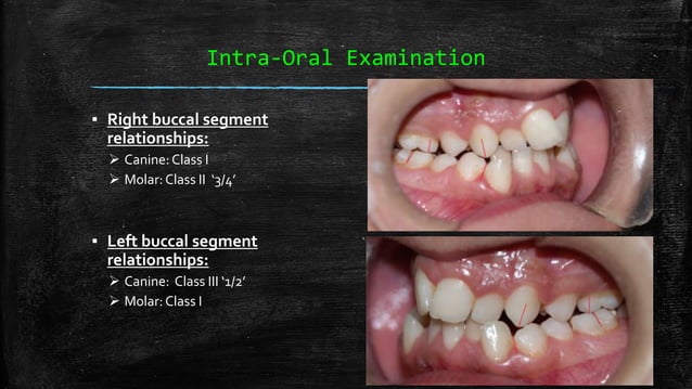 Orthodontic clinical case presentation - Dr shareef alshanableh | PPTX