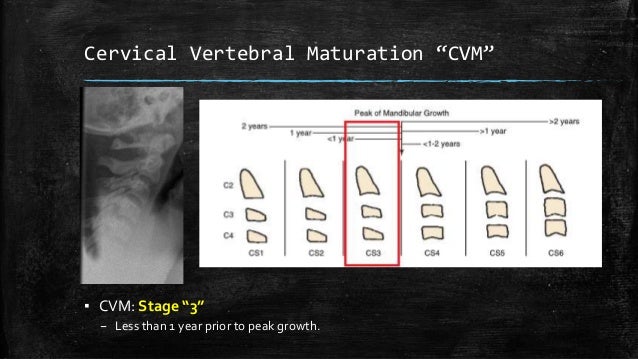 Orthodontic clinical case presentation - Dr shareef alshanableh