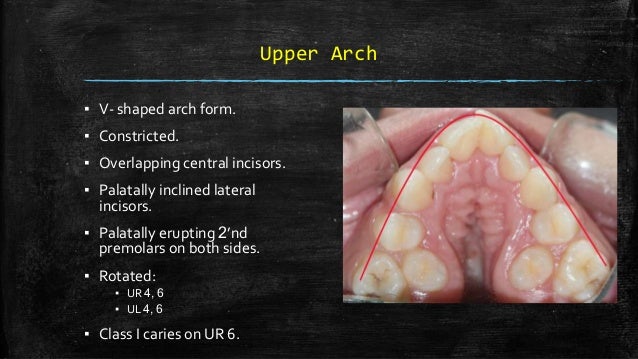 Orthodontic clinical case presentation - Dr shareef alshanableh
