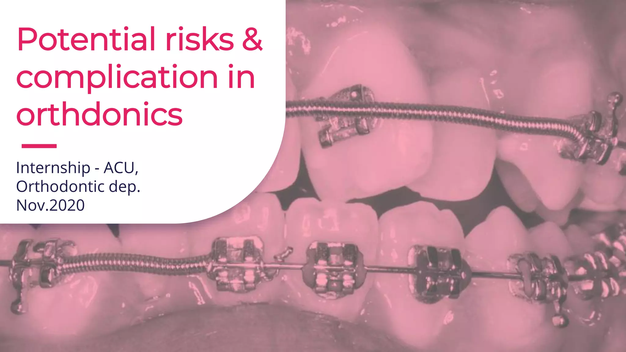 Orthodontic risks and complications | PDF