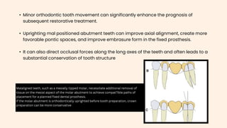 Orthodontic Consideration In Fixed partial denture.pptx
