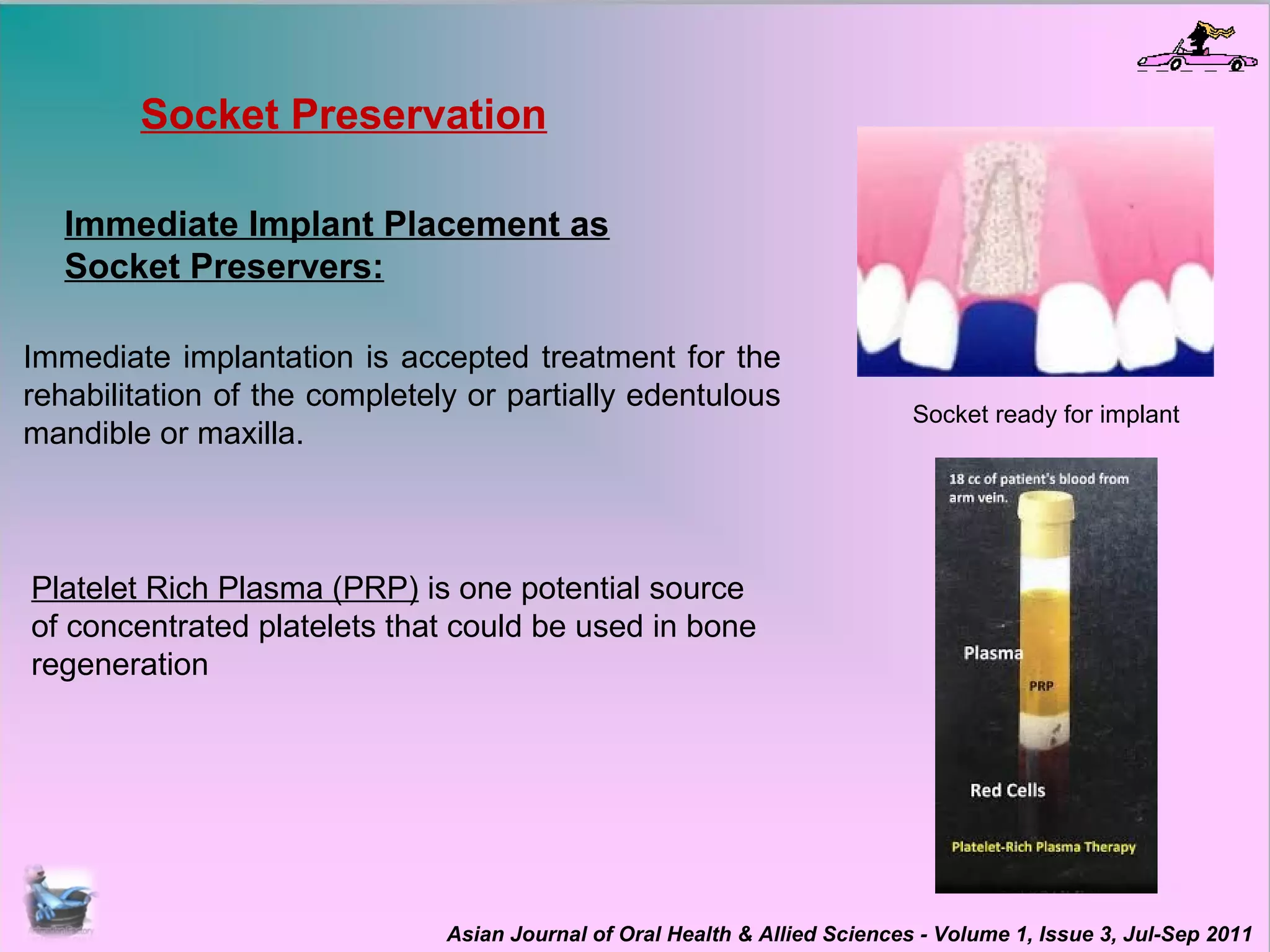 Orthodontic consideration of the old extraction site | PPT