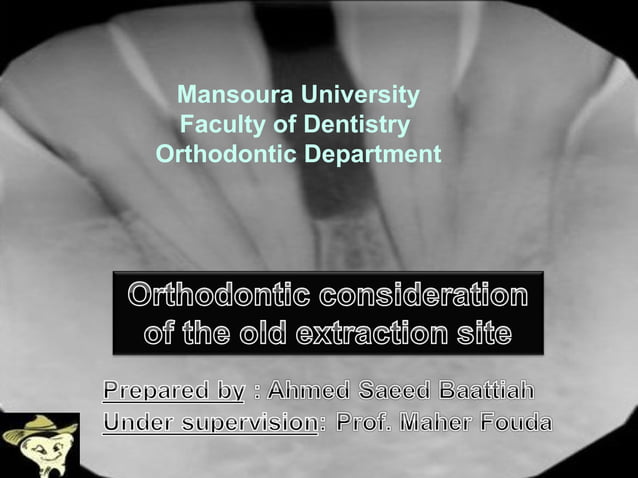Orthodontic consideration of the old extraction site | PPT | Bone and ...