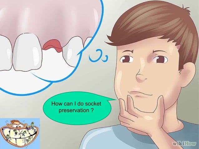 Orthodontic consideration of the old extraction site | PPT | Bone and ...